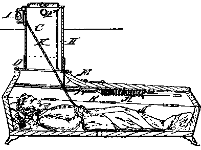 Buried Alive! A short history of premature burial and safety coffins ...